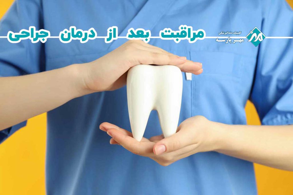 مراقبت بعد از درمان جراحی دندان نکات طلایی باید و نبایدها کلینیک
